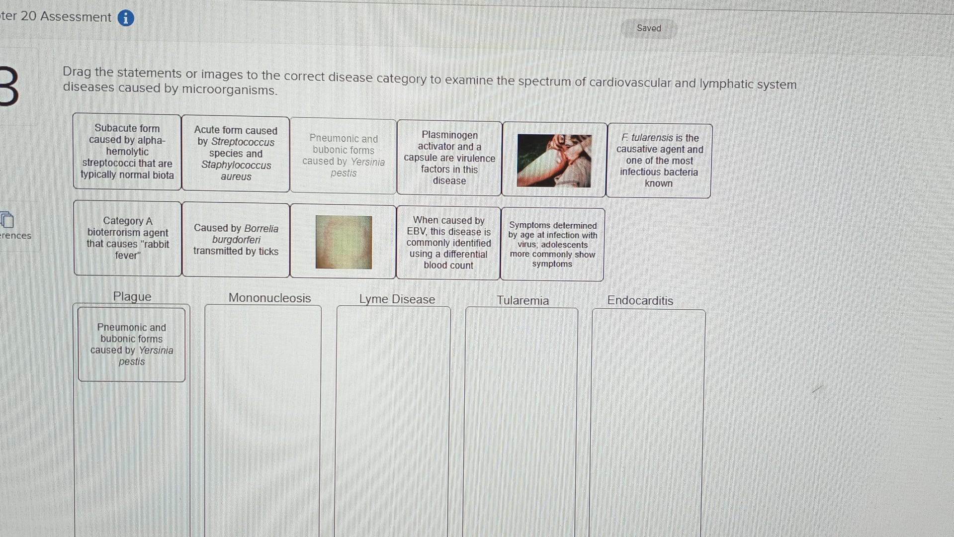 Solved Drag the statements or images to the correct disease | Chegg.com