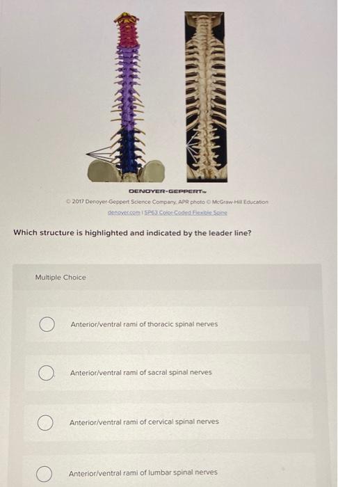 Solved 10 DENOVER-GEPPERT 2017 Denoyer-Geppert Science | Chegg.com