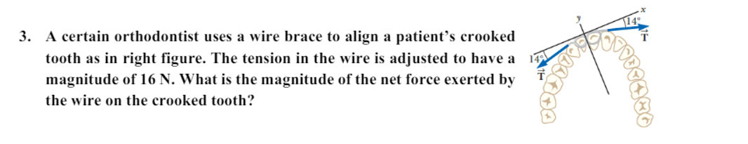 Solved A certain orthodontist uses a wire brace to align a | Chegg.com Solved A certain orthodontist uses a wire brace to align a | Chegg.com
