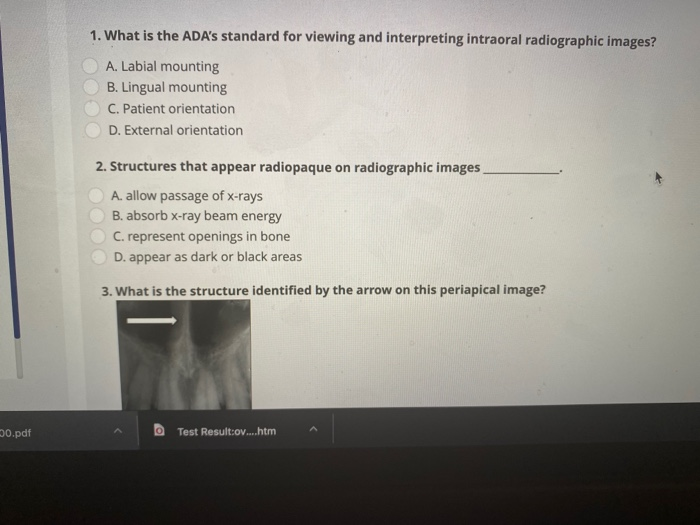 Solved 1. What is the ADA's standard for viewing and | Chegg.com