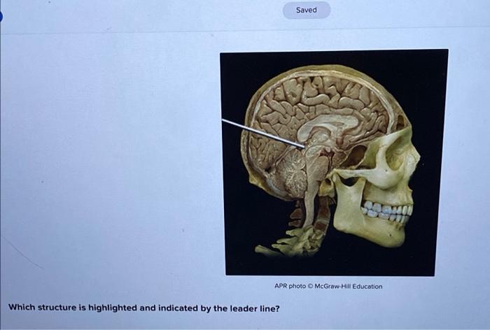 Solved Saved APR photo McGraw-Hill Education Which structure | Chegg.com