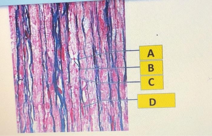 Solved А B C D This shows a nerve (a bundle of axons in | Chegg.com