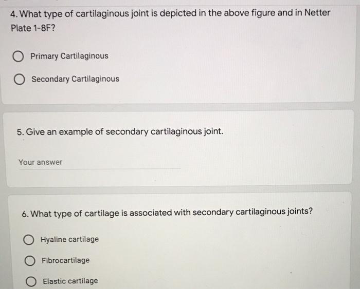 Solved 1. Fibrous joints as shown below and in Netter Plate | Chegg.com