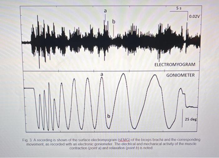 Session 2: Voluntary contraction, EMG relationship | Chegg.com