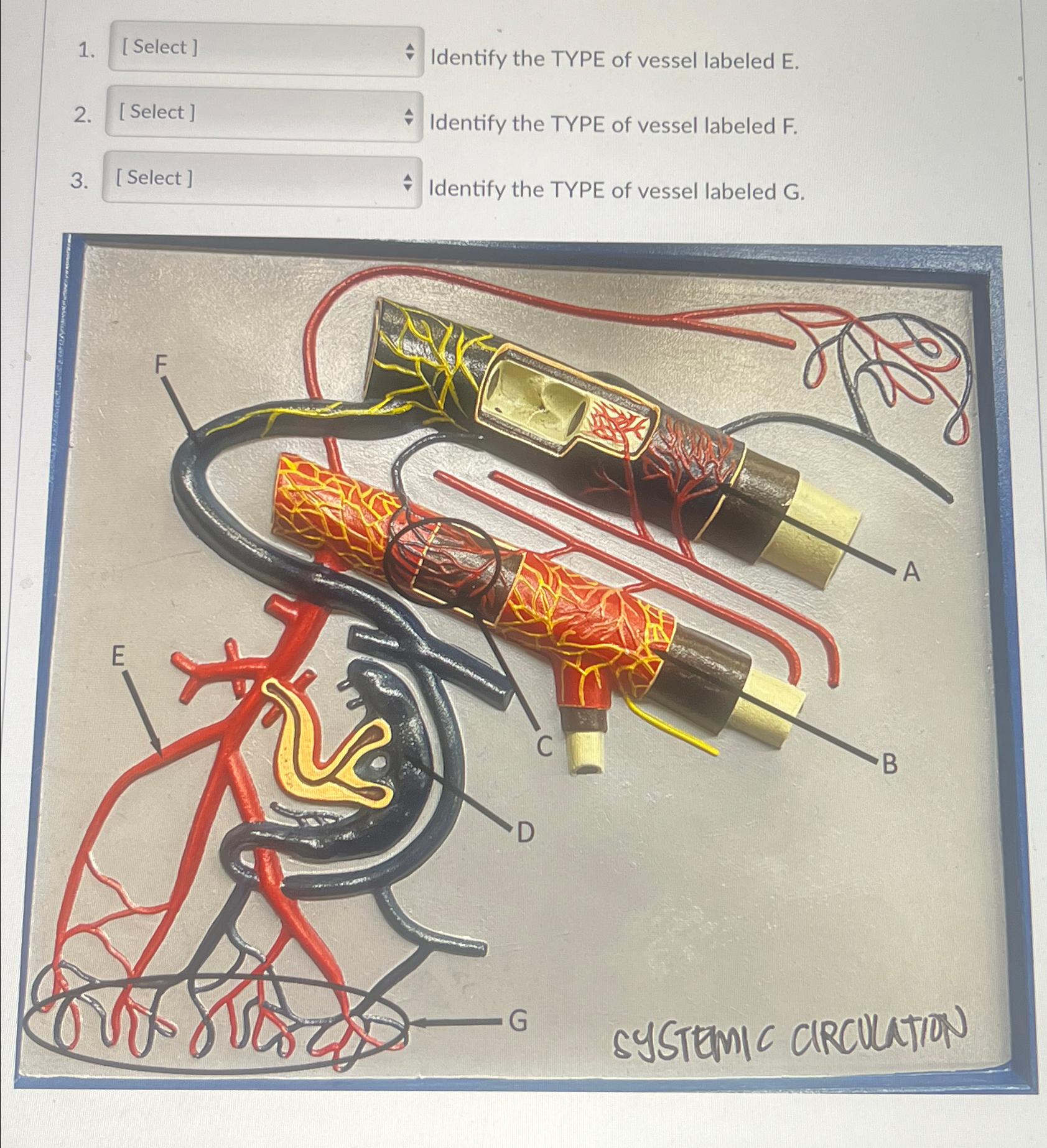 Solved Identify the TYPE of vessel labeled E.Identify the | Chegg.com