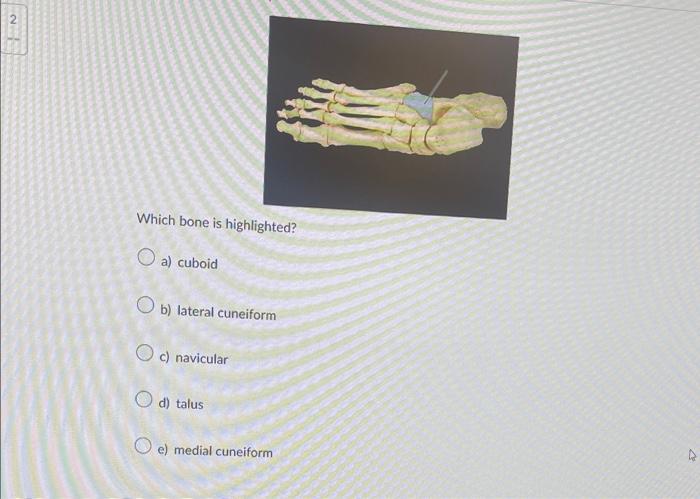 Solved Which bone is highlighted? a) cuboid b) lateral | Chegg.com