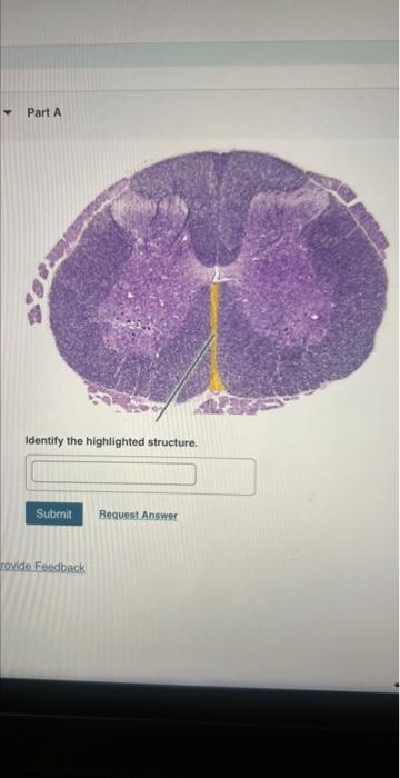 Solved Identify the highlighted structure. | Chegg.com