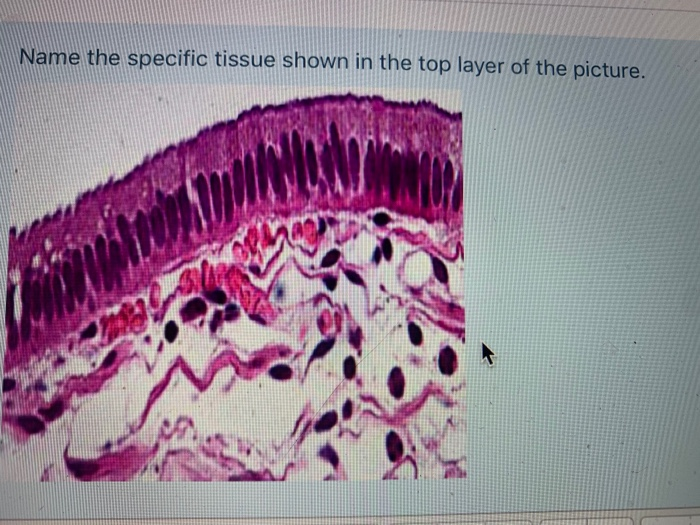 Solved Name the specific tissue shown in the top layer of | Chegg.com