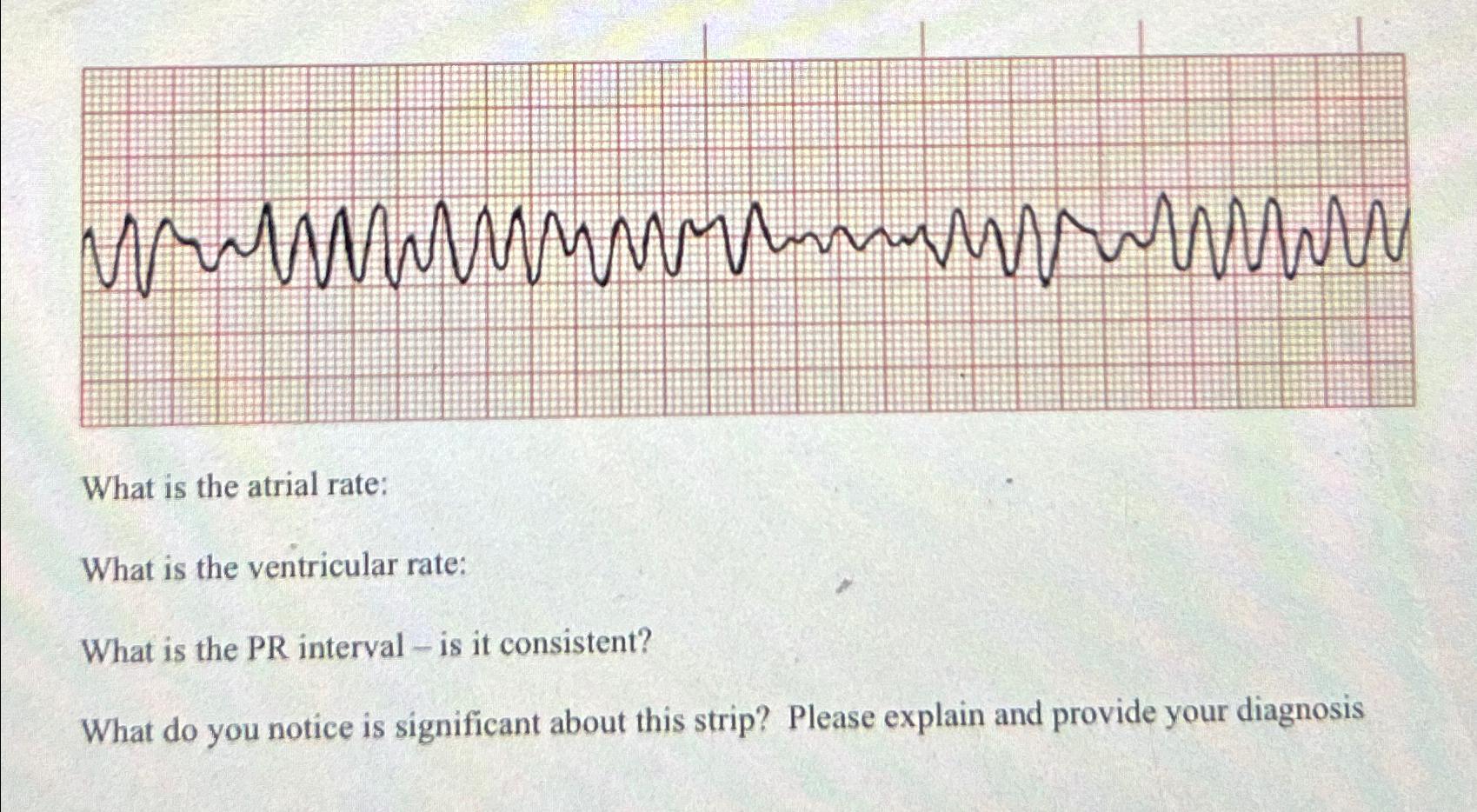 Solved What is the atrial rate: | Chegg.com