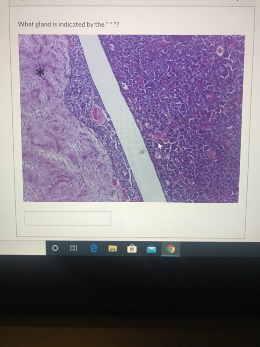 Solved What gland is indicated by the "*"? о вi e а в | Chegg.com