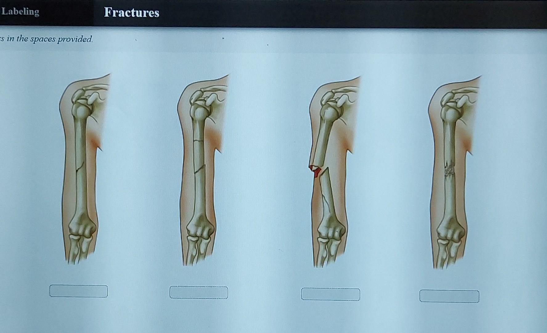 Solved in the spaces provided. | Chegg.com