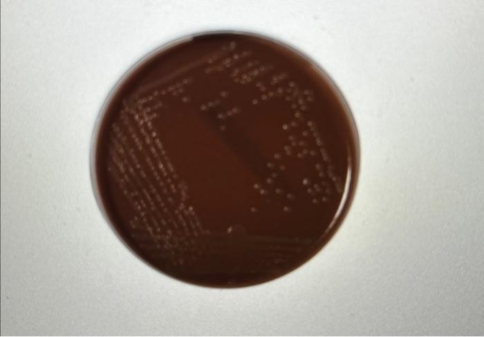 shown below is a chocolate agar plate. based on the | Chegg.com