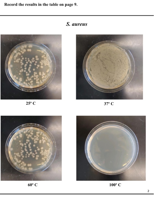Solved LAB 2: 1. Observe all plates for the amount of | Chegg.com
