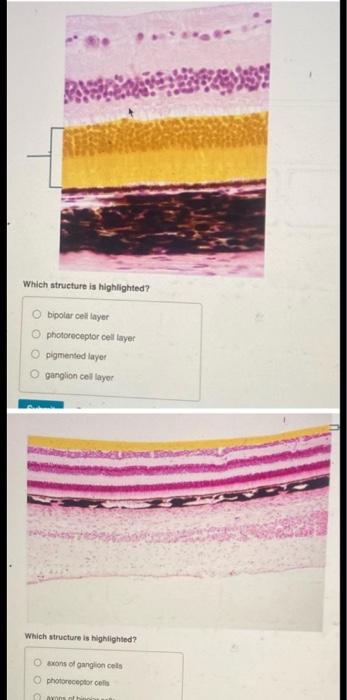 .. Which structure is highlighted? bipolar cell layer | Chegg.com
