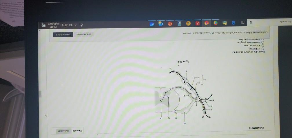 Solved 2 points Arwer QUESTION 15 QUESTIONS 11 12 Figure | Chegg.com