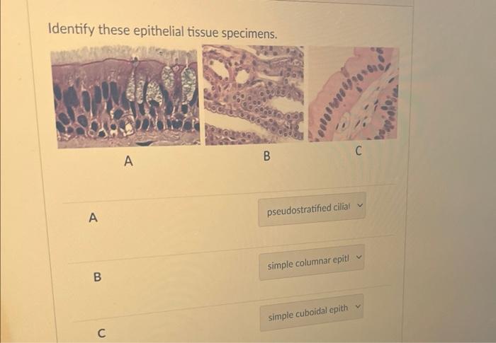 [Solved]: Identify these epithelial tissue specimens.