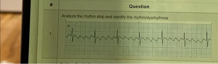 Solved Question Analyze the rhythm strip and identify the | Chegg.com