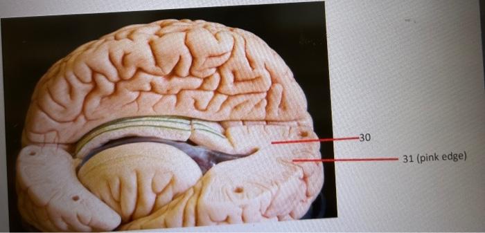 Solved help me identify arrows | Chegg.com Solved help me identify arrows | Chegg.com