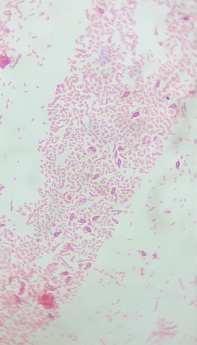 Solved list the possible microorganisms on the gram stain | Chegg.com