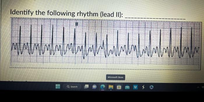 Solved Identify the following rhythm (lead II): | Chegg.com