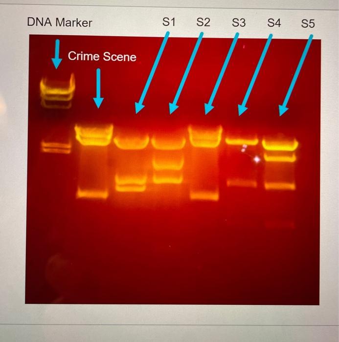 Solved DNA Marker S1 S2 S3 S4 S5 Crime Scene 7. Which | Chegg.com