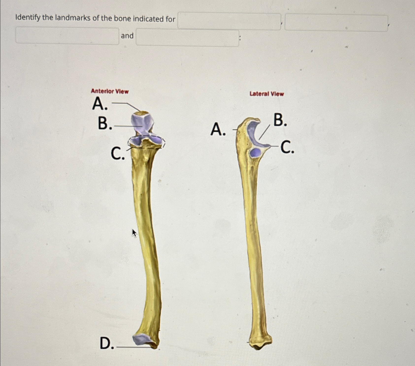 Solved Identify the landmarks of the bone indicated | Chegg.com