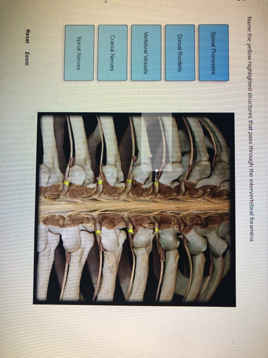Solved Name the yellow highlighted structures that pass | Chegg.com