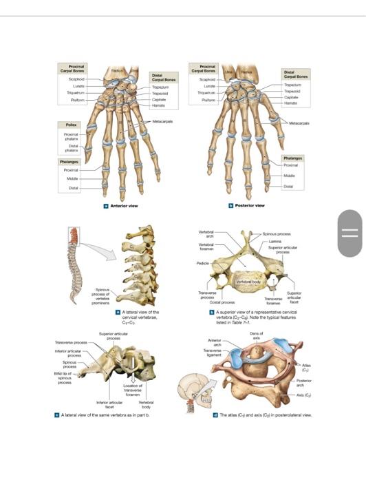 Solved Osteon Lacunae Central canal Lamellae Osteons SEM X | Chegg.com