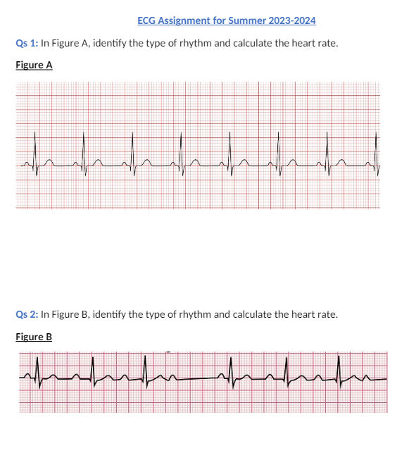 Solved ECG Assignment for Summer 2023-2024Qs 1: In Figure A, | Chegg.com