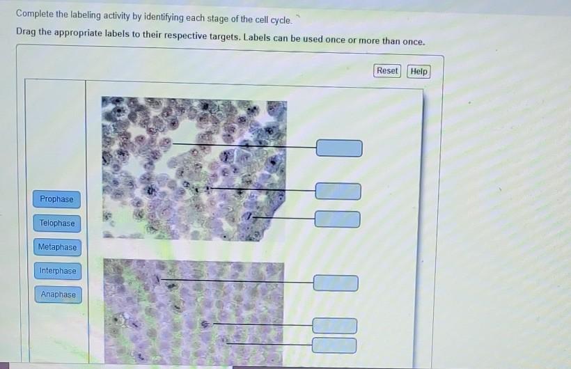 Solved Complete the labeling activity by identifying each | Chegg.com