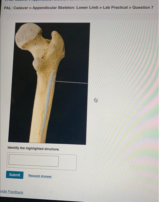 Solved PAL: Cadaver > Appendicular Skeleton: Lower Limb > | Chegg.com Solved PAL: Cadaver > Appendicular Skeleton: Lower Limb > | Chegg.com