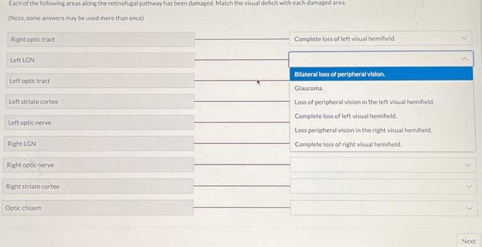 Solved Each of the following areas along the retinofugal | Chegg.com