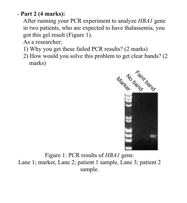 Solved Part 2 (4 marks): After running your PCR experiment | Chegg.com