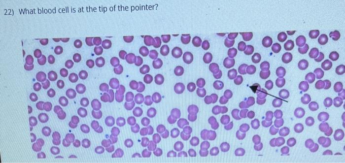 Solved 22) What blood cell is at the tip of the pointer? | Chegg.com