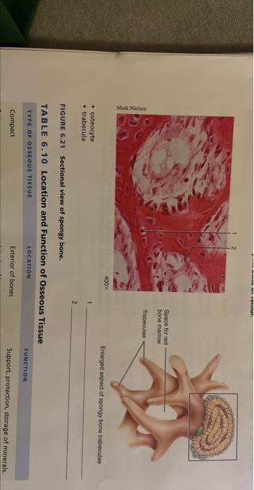 [Solved]: - osteocyte Enlarged aspect of spengy bone trabec