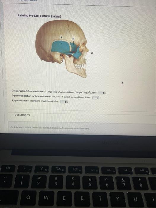 Solved QUESTION 7 Labeling Pre-Lab: Features of Cranial | Chegg.com