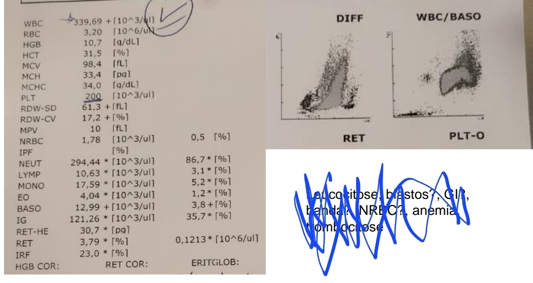 Solved thrombocytosis? nbcr? ﻿anemia? ig? ﻿leukocytosis? | Chegg.com