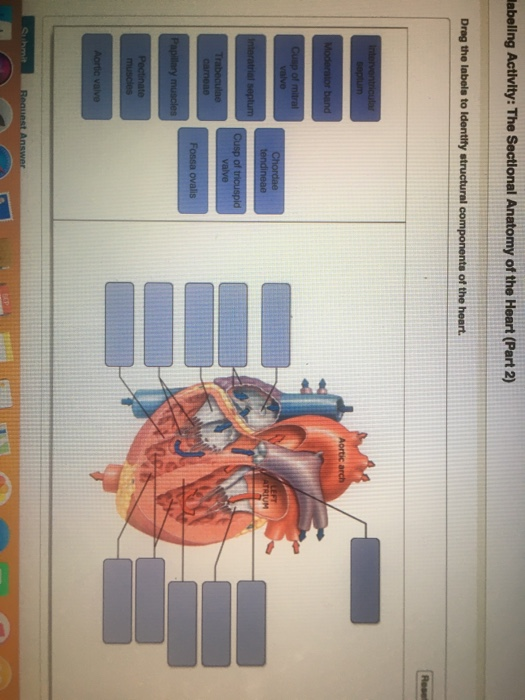 Solved labeling Activity: The Sectional Anatomy of the Heart | Chegg.com