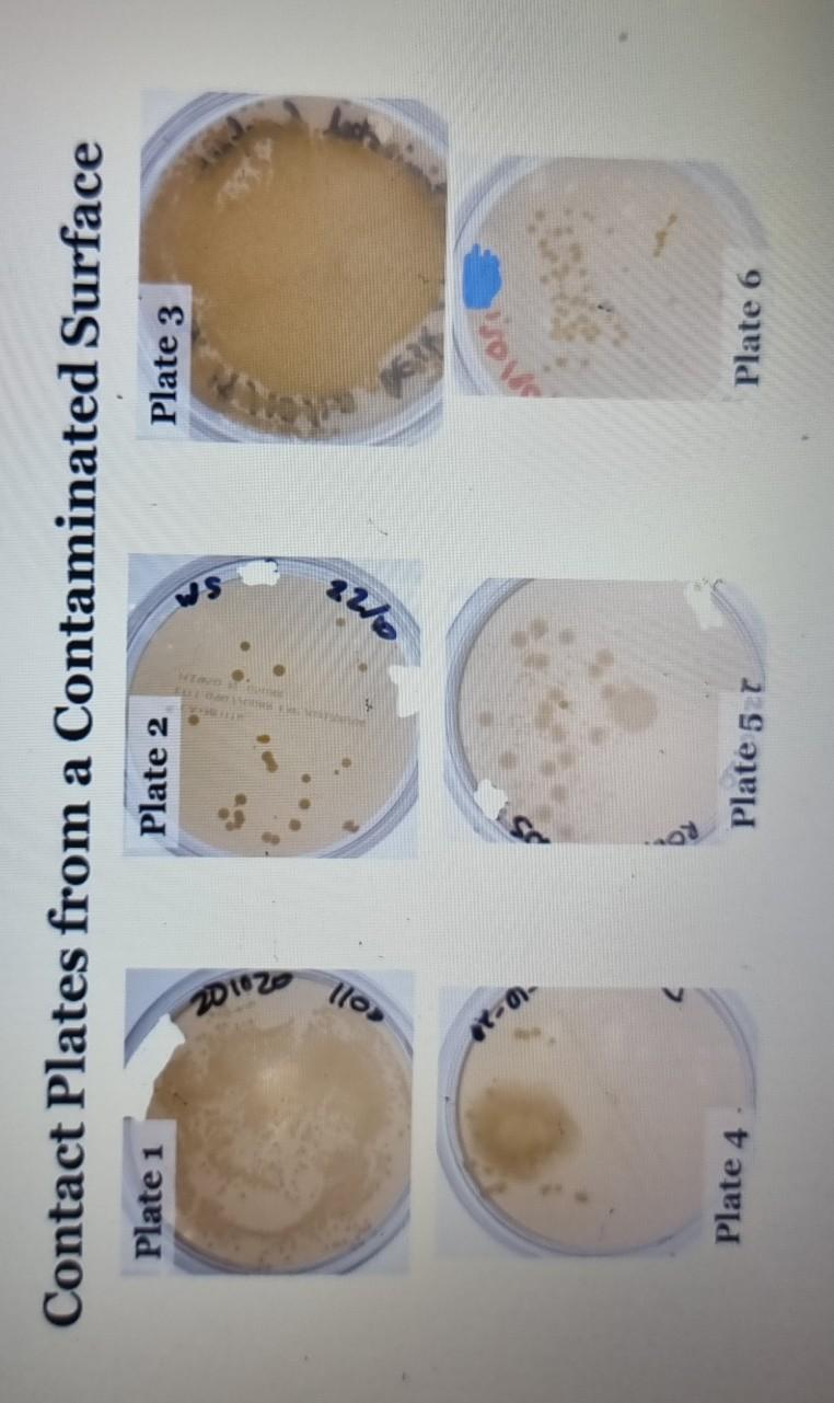 Solved Contact Plates from a Contaminated Surface Plate 1 | Chegg.com