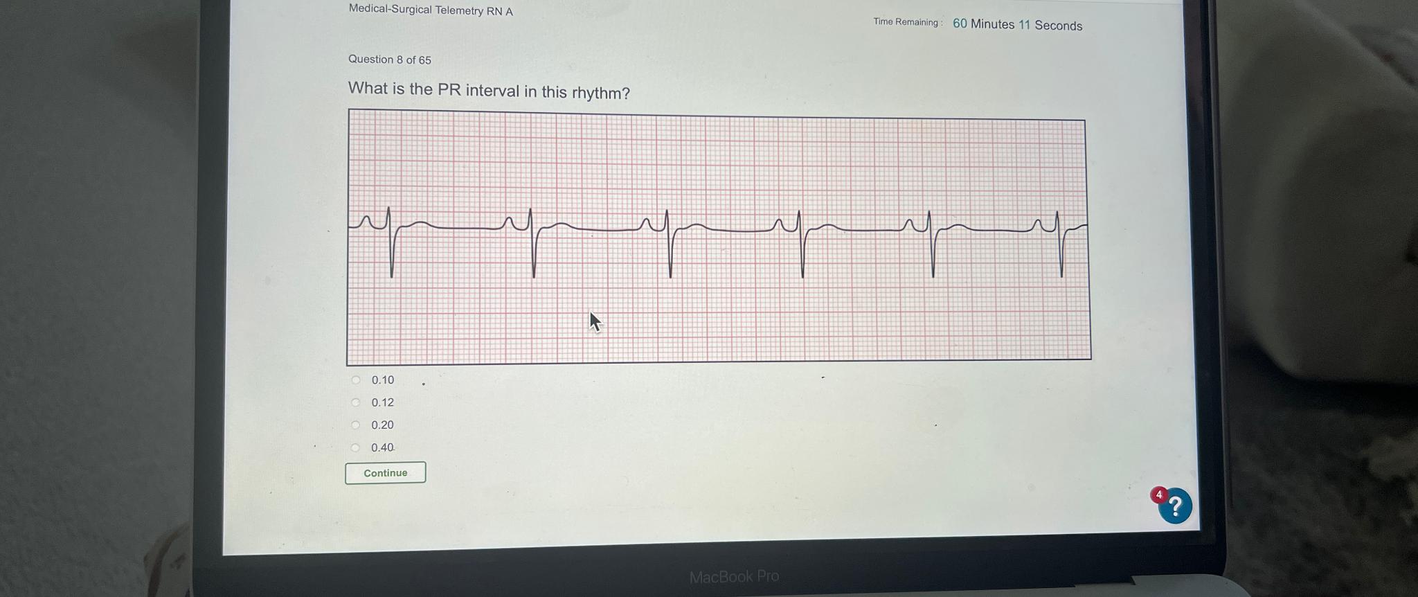 Solved Medical-Surgical Telemetry RN ATime Remaining60 | Chegg.com