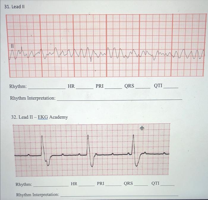 Solved whats the rhythm, HR, PRI, QRS, QTI, and Rhythm | Chegg.com