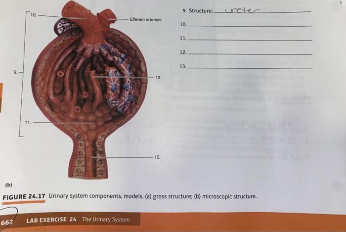 Solved Anatomy of the Urinary System 1. Complete the | Chegg.com