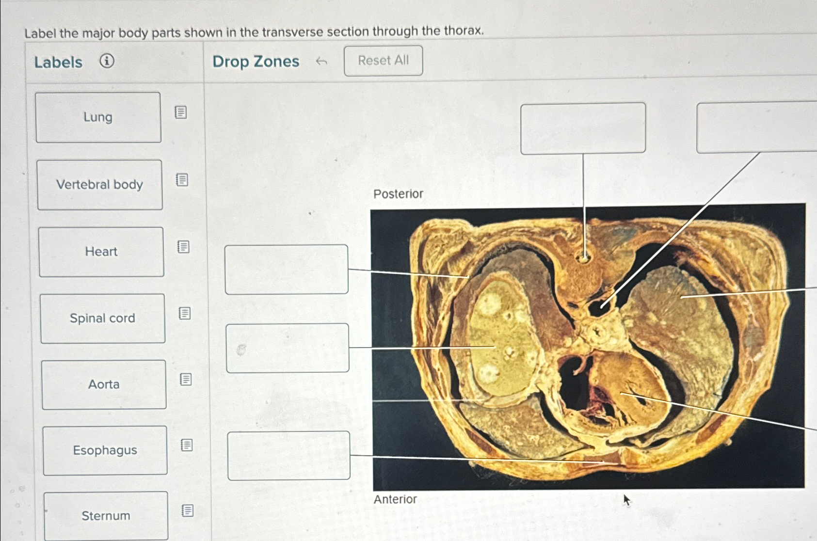 Solved Label the major body parts shown in the transverse | Chegg.com