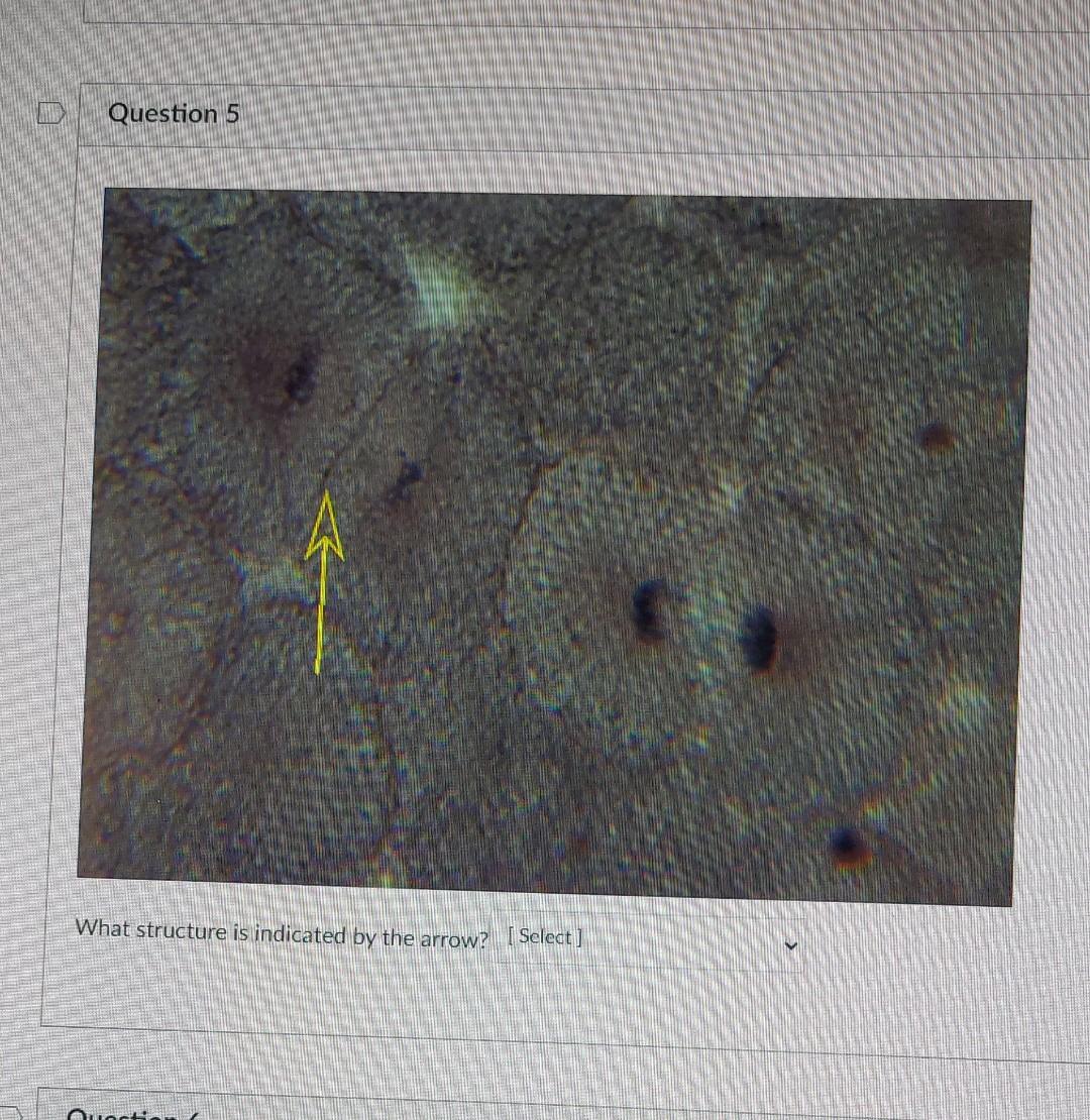 Solved Question 5 What structure is indicated by the arrow? | Chegg.com