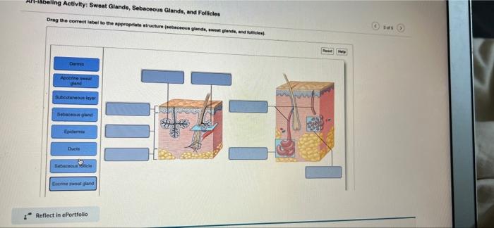 Solved -labeling Activity: Sweat Glands, Sebaceous Glands, | Chegg.com