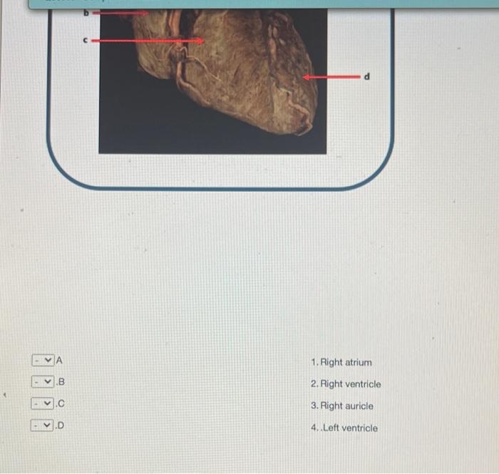 Solved Labeling: Label the image below. External Heart | Chegg.com