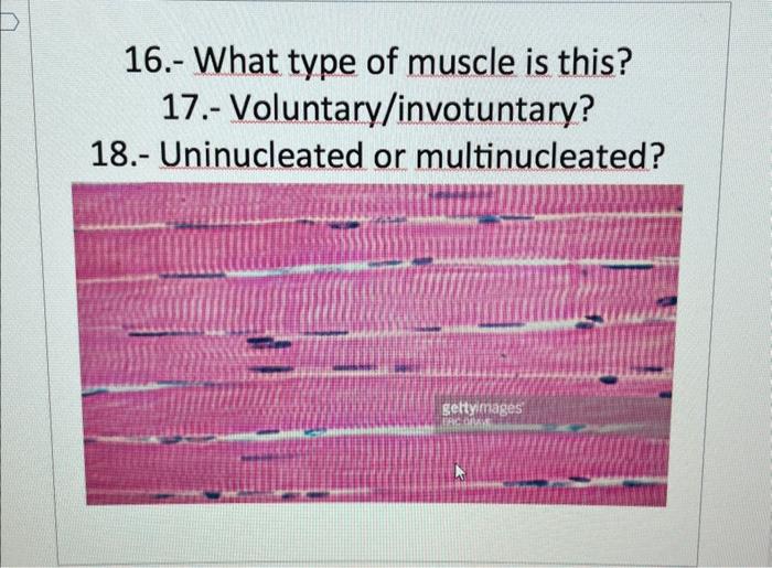 Solved 16.- What type of muscle is this? 17.- | Chegg.com