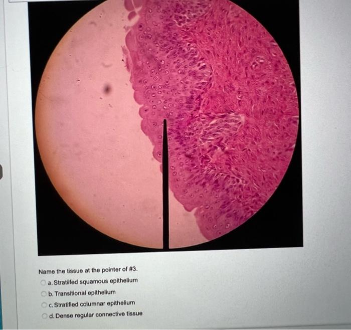 Solved Name the tissue at the pointer of #3. a. Stratifed | Chegg.com