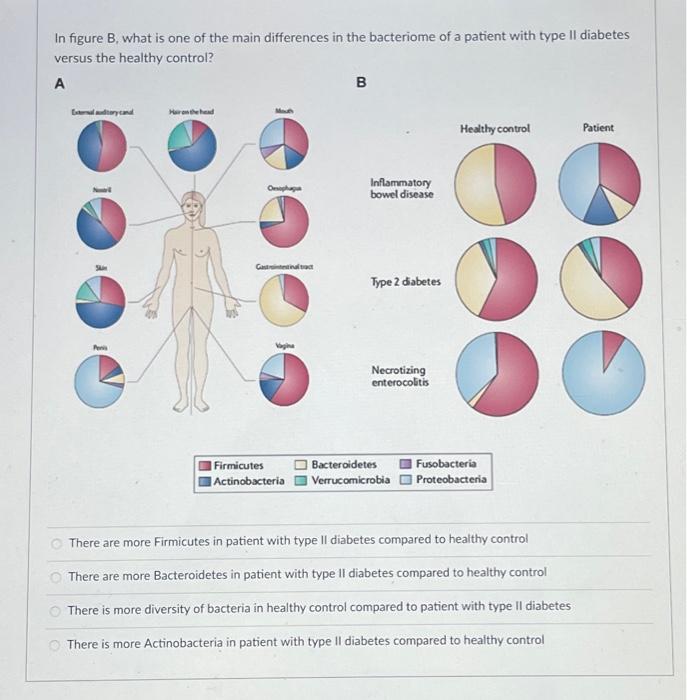 Solved In figure B, what is one of the main differences in | Chegg.com