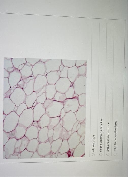 Solved adipose tissue simple squamous epithelium areolar | Chegg.com